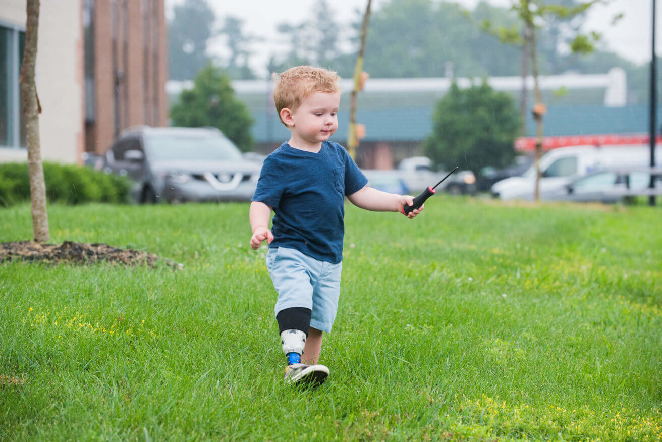 Your Perfect Fit For Keeping Up With Kids Prosthetic Needs